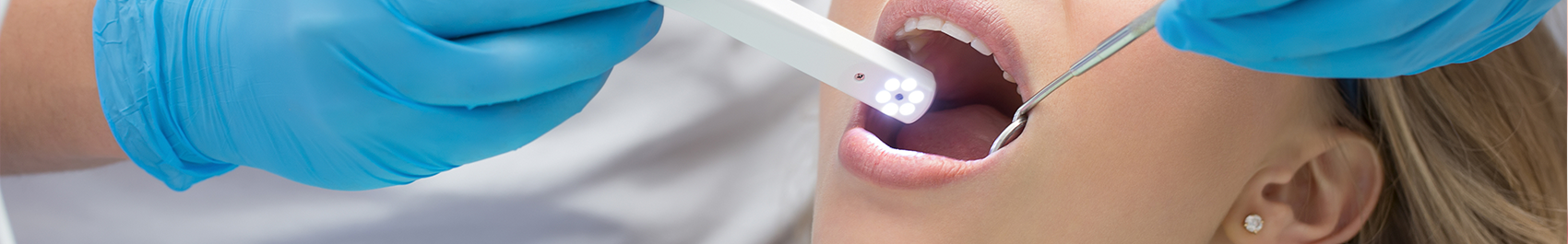 Intraoral Photography - Intraoral Camera - Timothy Calkins, DDS